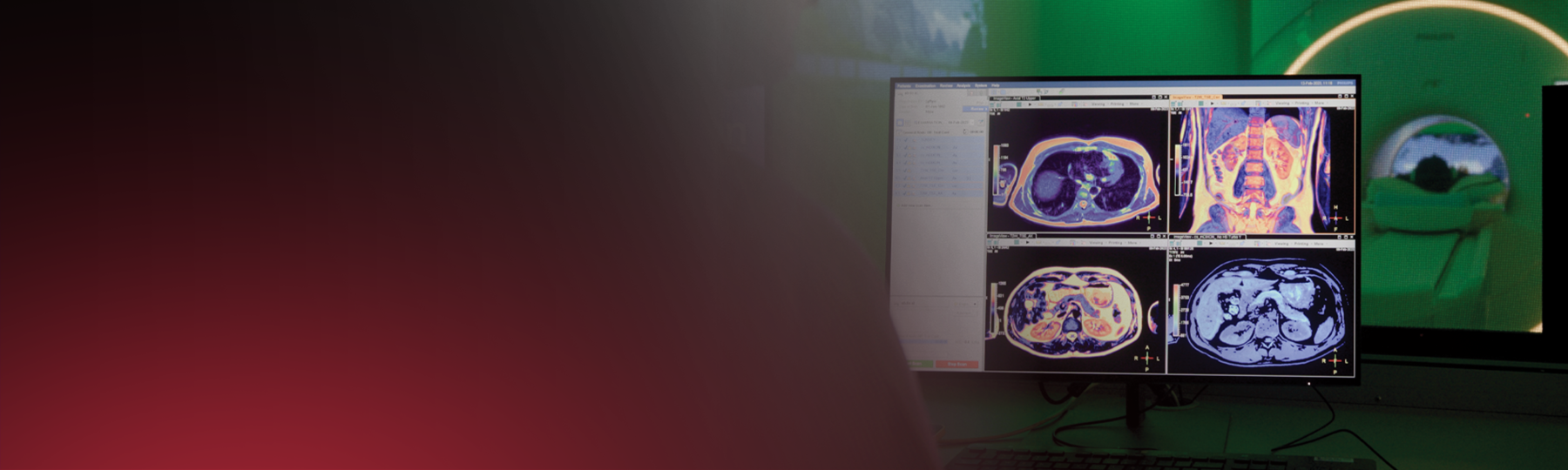 InteleConnect and InteleViewer | South East Radiology